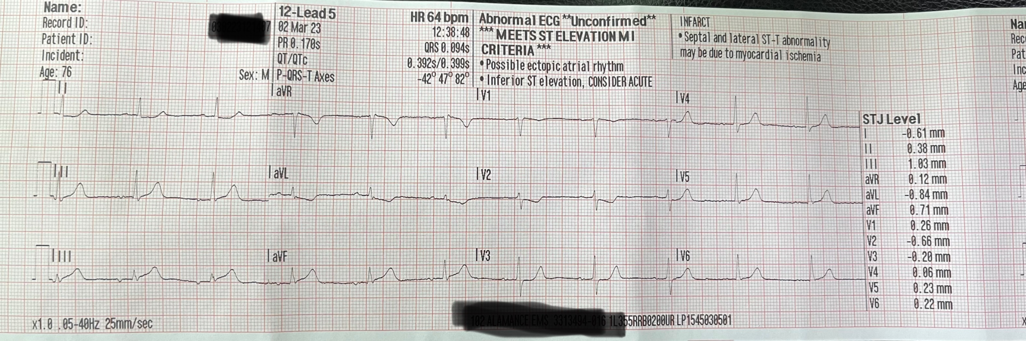 The Truth About Nitro: Separating Fact from Fiction - Loud & Clear: EMS ...
